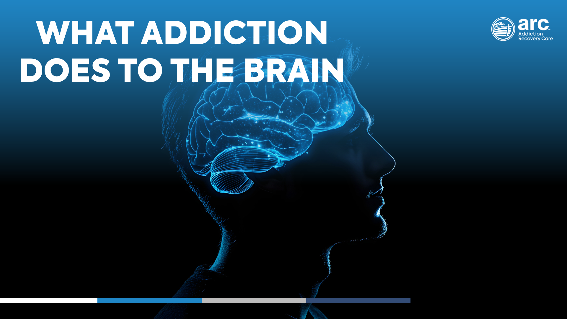 The Science of Addiction: What Really Happens in the Brain - Addiction ...